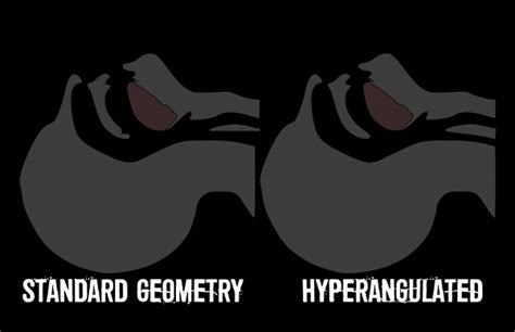 Angioedema Crossroads