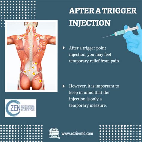 trigger point injection is all we need to know in mansfield tx