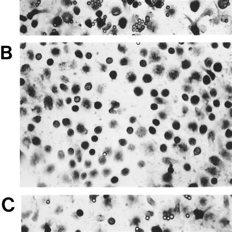 Fibronectin Bead Binding Is Reduced When T Cells Adhere To Icam 1 Download Scientific Diagram