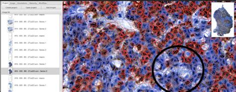 Misclassification In Qupath And Recommendations Image Analysis