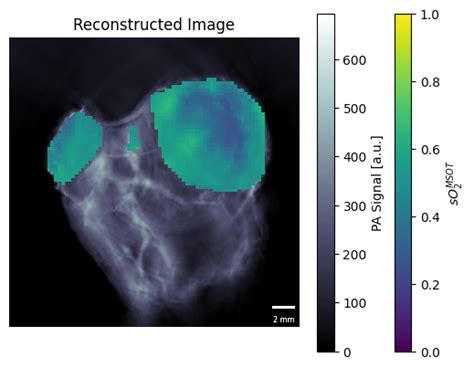 1 Reconstructing Photoacoustic Data — Patato Documentation