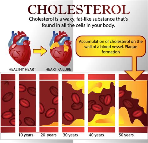 How To Reduce Cholesterol