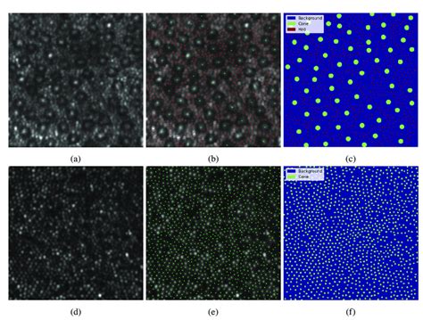 A An Example 10 • Nr Ao Slo Image B Manual Annotations On The Download Scientific