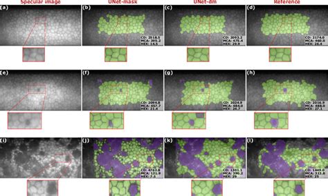 Comparison Between Unet Mask And Unet Dm In One Example Of A D Download Scientific Diagram
