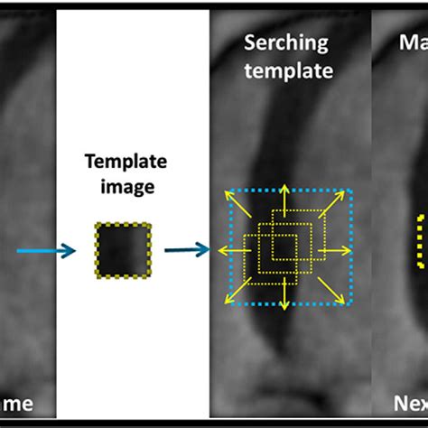 Template Matching Algorithm In Mtt Software Download Scientific Diagram