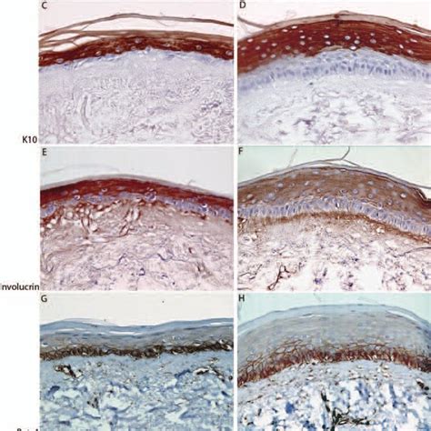 Fibroblasts Remain Present In The Dermis Upon Centrifugation Vimentin