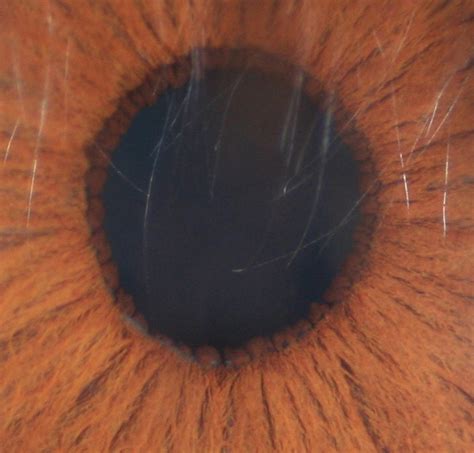 Modern And Multidimensional Iridology Important Iris Signs At Ipb Pupil