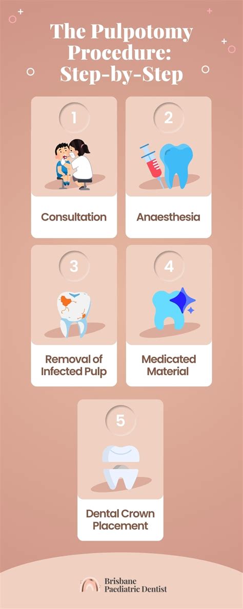 Pulpotomy Understanding The Pulpotomy Procedure