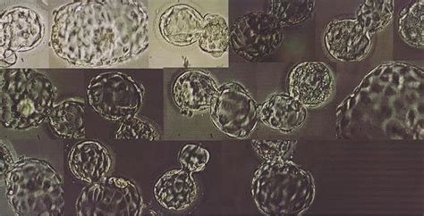 Lucas Nazareth Msc Mba On Linkedin Day 5 And 6 Blastocyst Hatching