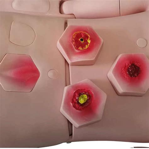 Advanced Mul Tifunctional Female Patient Nursing Training Manikin