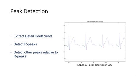 Ecg Signal Analysis For Myocardial Infarction Detection Ppt