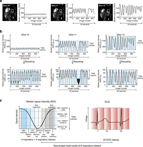 Respiratory Signal Exemplary Illustration Slices 1012 Demonstrating Download Scientific
