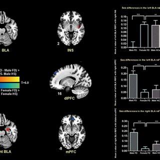 Sex Differences In The RsFC Between Amygdala Subregions And The Whole Download Scientific