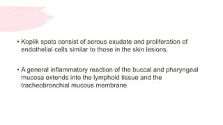 Measles Pptx