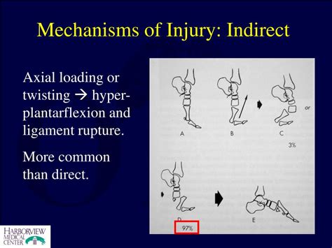 Ppt Midfoot Fractures And Dislocations Powerpoint Presentation Free Download Id3823468
