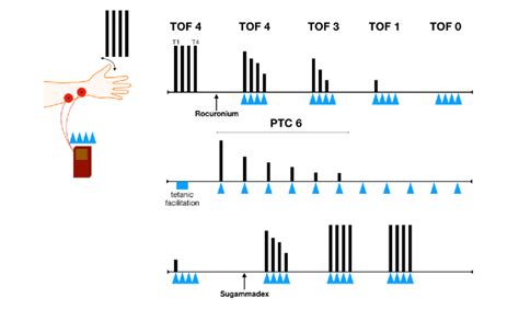 Tof Monitoring