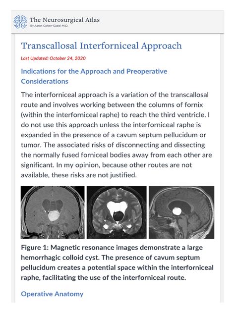 Transcallosal Interhmemishperic Approach Pdf
