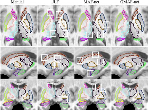 Visualization Of Segmentation Results Of One Representative Image From Download Scientific