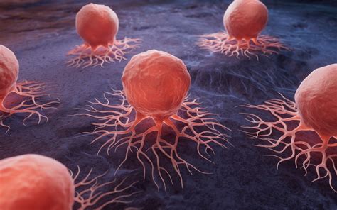 Inflammatory Proteins Linked To Higher Risk Of Endometrial Cancer