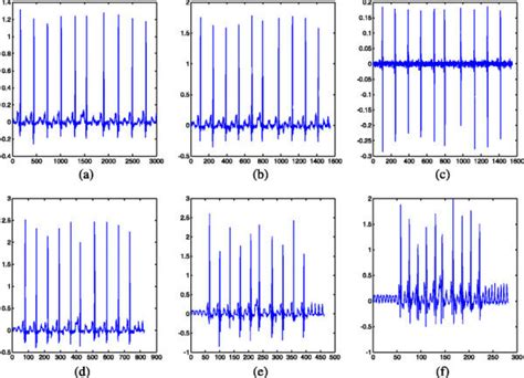 Wpd Of Ecg Signals A Original Signal B F Decomposed Ecg Signals At Download Scientific