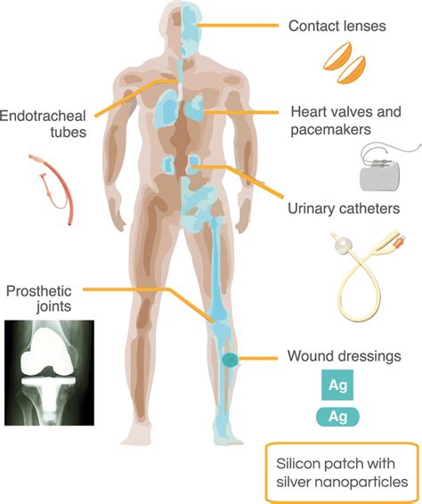 Illustrative Scheme Of Several Silicon Based Biomedical Implants And