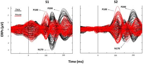 Neurophysiological Correlates Of Featural And Spacing Processing For