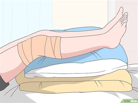 How To Reduce Swelling After Knee Surgery 9 Home Remedies