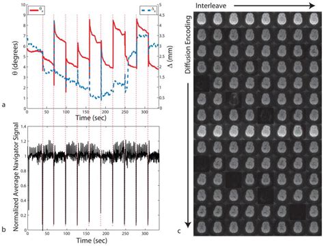 Real Time Optical Motion Correction For Diffusion Tensor Imaging
