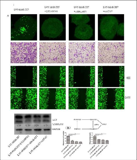 March7 Promoted Tgf β Induced Autophagy Migration And Invasion
