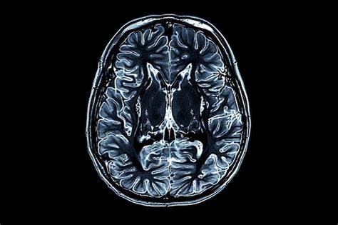 brain scan mri image generative ai premium ai generated image