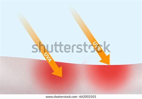 Uva And Uvb Rays With Skin Layer Over Royalty Free Licensable Stock Photos Shutterstock