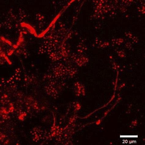 Confocal Microscope Image Of Trichoderma Atroviride T 77tdtomato