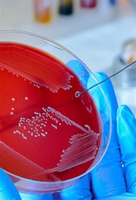 Cannabis Microbial Testing Nova Analytic Labs