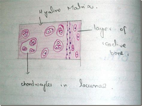 Histology Slides Database Chondroma Histopathology Diagram