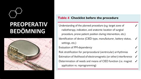 Pacemaker Overview Device And Electrodes Explained The Anesthesia Guide