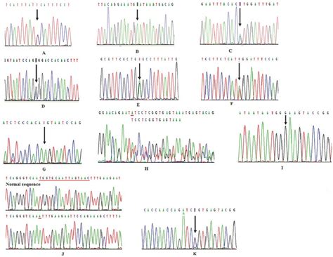 Phex Gene Mutation Sequencing Diagram A A Nonsense Mutation