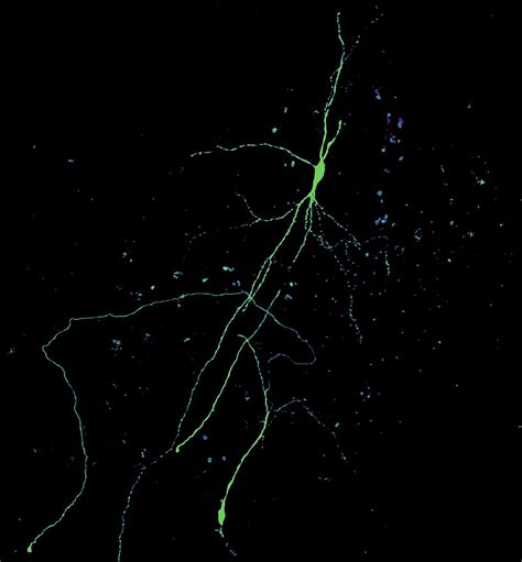 Effects Of Stress On Dopamine Circuit Structure And Function Lerner