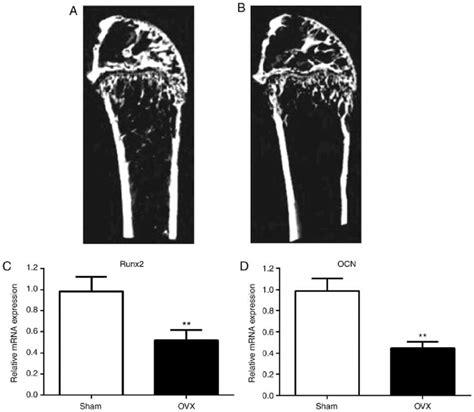 Bone Formation And Osteoblast Differentiation Is Reduced In Ovx Mice