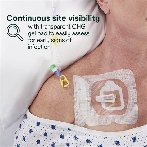 Tegaderm™ Chg Chlorhexidine Gluconate Gel Pad 1664r