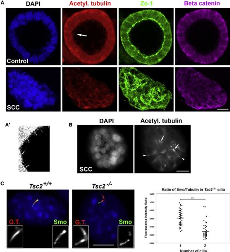 Disease Related Defects Associated With Presence Of Extra Cilia A B Download Scientific