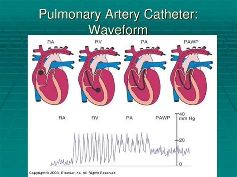 Ppt Hemodynamic Monitoring Powerpoint Presentation Id4750943
