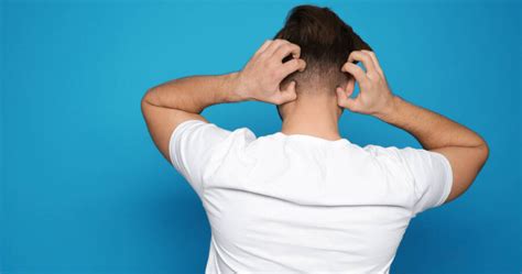 Understanding Scalp Psoriasis What You Need To Know Questions Wiki