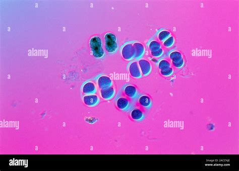Light Micrograph Of The Unicellular Cyanobacteria Blue Green Algae Chroococcus Seen In Its