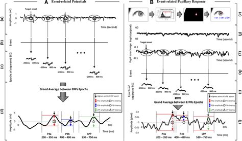 Overview Of Signal Processing With Definition Of Features In A Erp