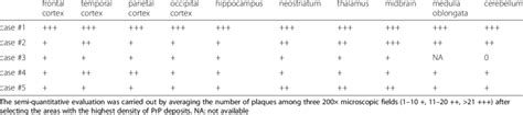Distribution Of Prp Sc Plaque Like Deposits 3f4 Immunopositive In The Download Table