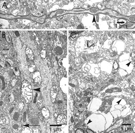 Electron Micrographs Of An Axon A Dendrite B And Neuropil C In Download Scientific