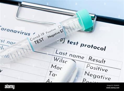 Close Up Negative Covid Test Tube And Medical Test Protocol Stock Photo Alamy