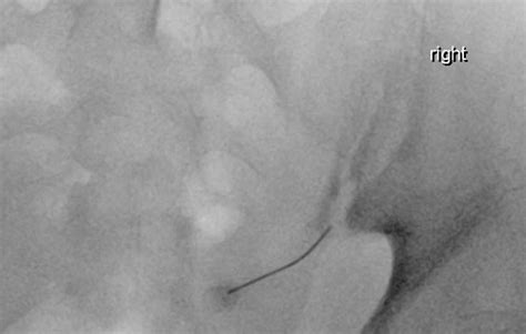 Fluoroscopy Omr