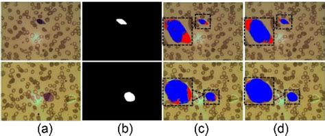Figure 1 From Deep Features Aggregation Based Joint Segmentation Of