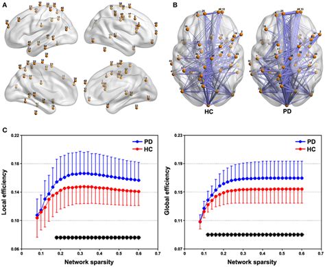 Between Group Differences In Network Efficiency A Brain Surface Download Scientific Diagram